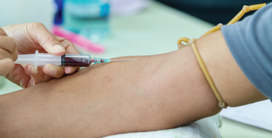 Cek Darah Lengkap Apa Saja? | Plazamedis.net